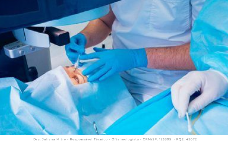 Como funciona o transplante de córnea? – Grupo HOSP