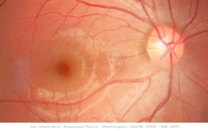 Retinografia: saiba como funciona a e quais os tipos de exame – Grupo HOSP
