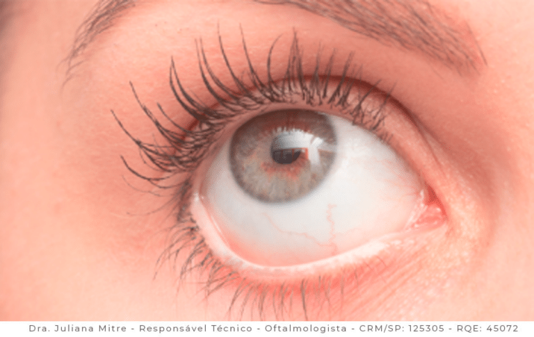 Nistagmo: O que é e quais os tipos – Grupo HOSP